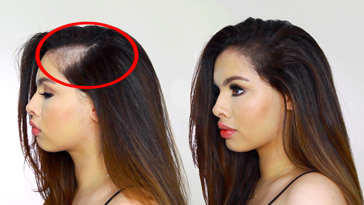 Sufría de pérdida del cabello hasta que mi amiga me recomendó este ...